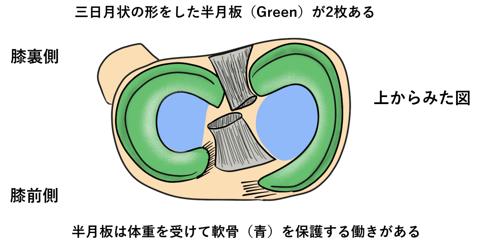 【膝の裏がズキッ！】内側半月板後根断裂とは？ 見逃すと人工関節のリスクも！ | 中村整形外科皮フ科｜津市半田の整形外科・皮膚科